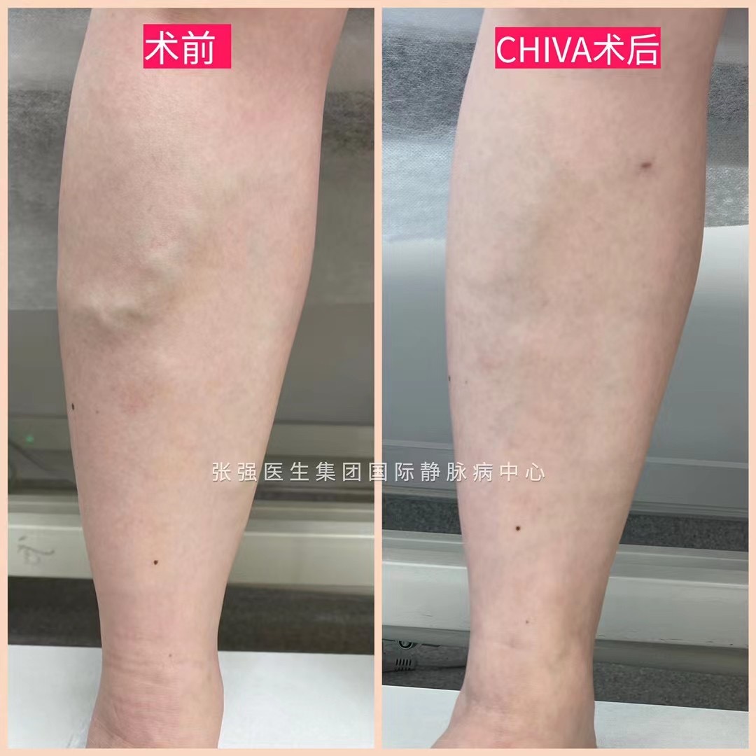 About us – 张强医生集团 Dr. Smile Medical Group 官方网站
